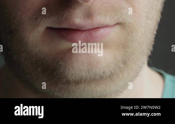 A young caucasian man with red stubble and a double chin with a mole on ...