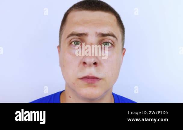 The yellow color of the man eye. Symptom of jaundice, hepatitis or ...