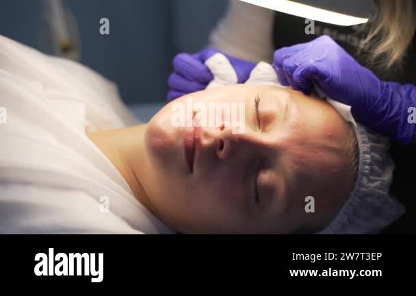Doctor squeezes out pimples on face of woman. Hands in gloves hold ...
