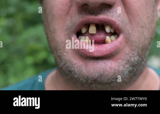 Close-up of the mouth of a toothless man. He moves his lips and shows a ...