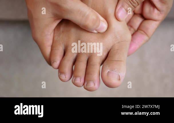 Closeup of female holding her painful feet and massaging her bunion ...