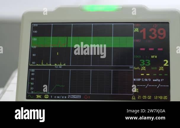 Electronic Cardiotocography Machine Monitoring Fetal Heart Contractions ...