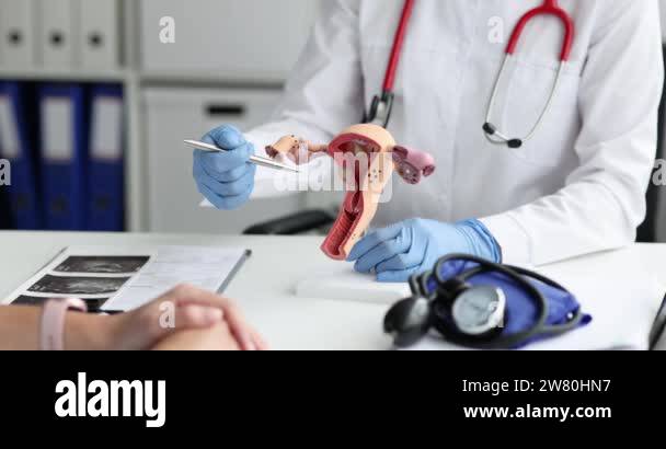 Doctor gynecologist showing patient female diseases on model of uterus ...