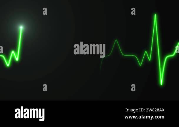 Glow heartbeat medical cardiogram. Pulse trace green line on black ...