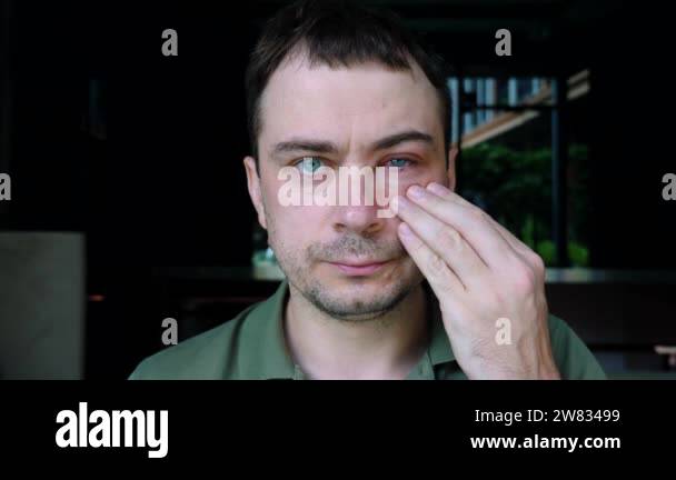 Sad Man Touch by Hand One Swollen Infected Eye with Symptom of ...