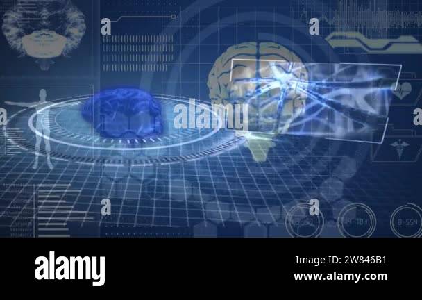 Animation of digital screens over scope scanning and digital brain ...