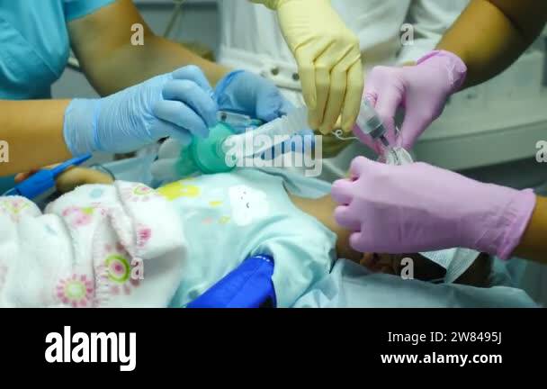 Patient child under anesthesia, little girl with oxygen mask to perform ...