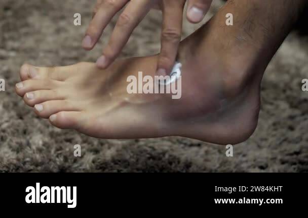 Close-up of a mans hand smearing a bruise on the foot, a sprain and a ...