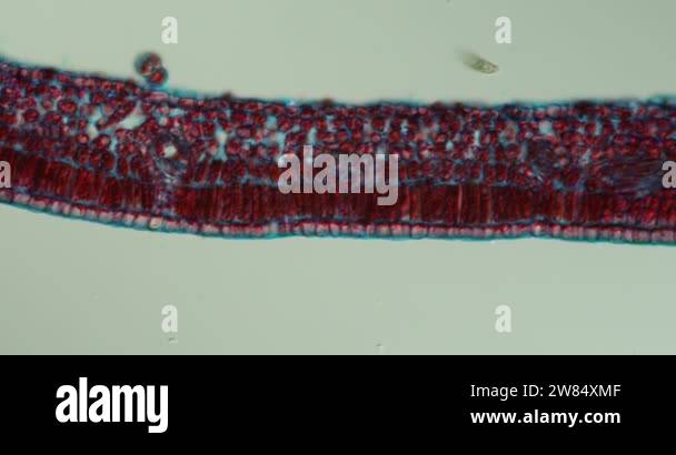 poisson evy leave tissue under the microscope 200x Stock Video Footage ...