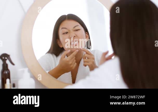 Problematic skin. Young upset asian lady squeezing pimple on her chin ...
