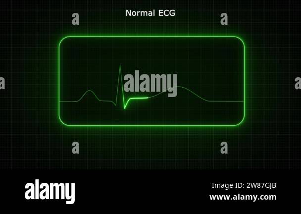 Green light glowing lifeline animation. Electric neon lighting follow ...