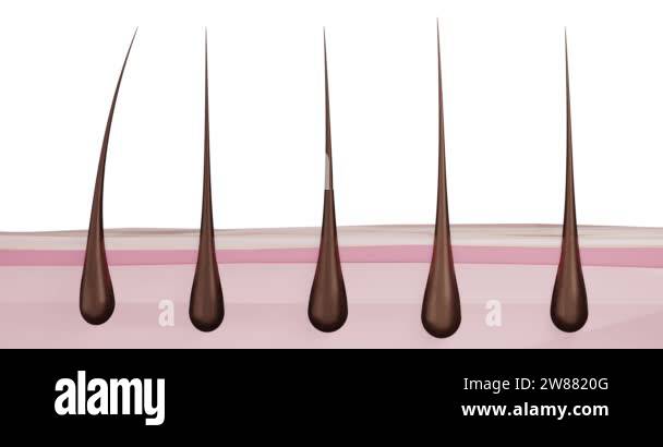Hair follicle Stock Videos & Footage - HD and 4K Video Clips - Alamy