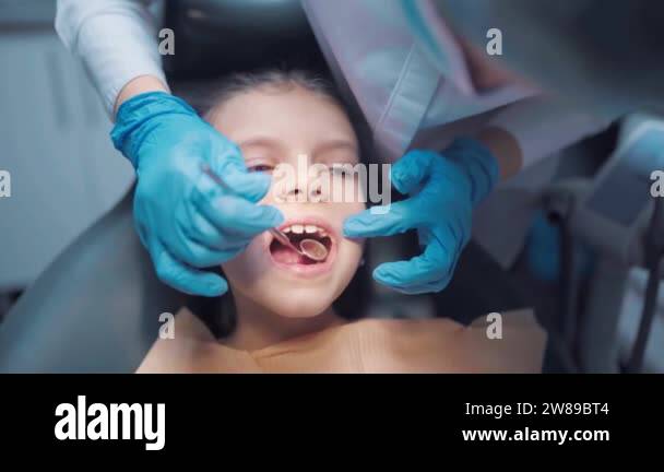 Closeup open mouth dental tools Stock Videos & Footage - HD and 4K ...