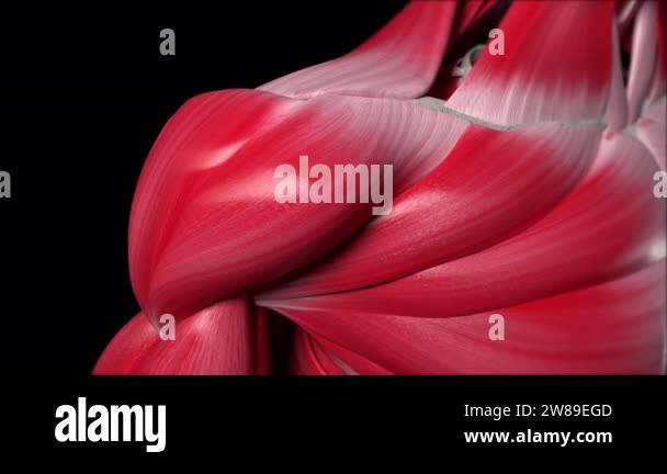 This 3d animation shows a shouder injury with l shaped tear of the ...