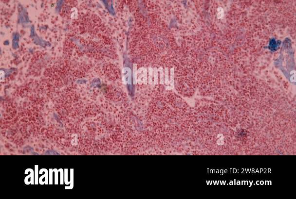 Lymph nodes in cross section under the microscope 100x Stock Video ...