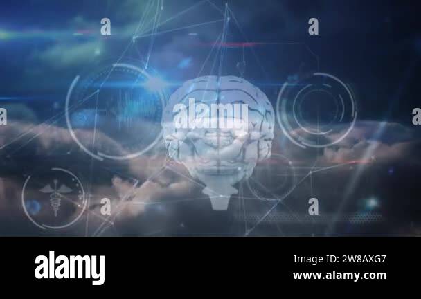 Animation of networks of connections over medical data processing with ...