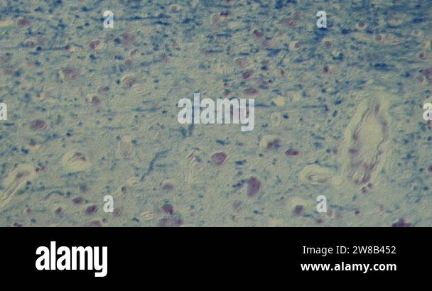 Nerve cells under the microscope 200x Stock Videos & Footage - HD and ...