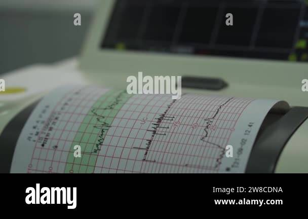 Electronic Cardiotocography Machine Monitoring Fetal Heart Contractions ...