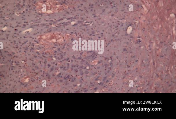 Brain cells microscope Stock Videos & Footage - HD and 4K Video Clips ...