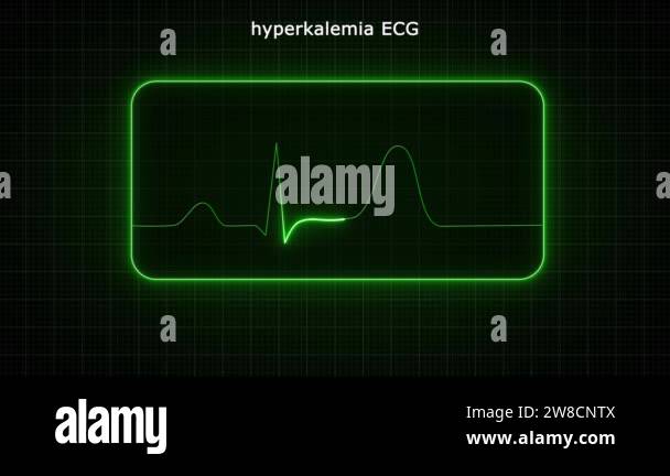 Green light glowing lifeline animation. Electric neon lighting follow ...