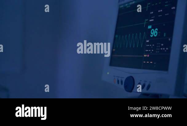 In the operating room of a hospital, a heart rate monitor is used. On ...