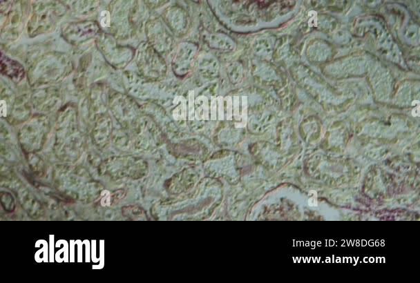 Toxic glands Stock Videos & Footage - HD and 4K Video Clips - Alamy