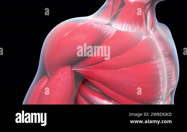 This 3d animation shows a shouder injury with small crescent tear of ...