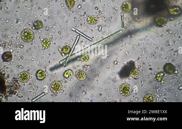 Green infusorias and bacillus with planktons move in drop of river ...