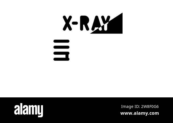 X ray radio equipment Stock Videos & Footage - HD and 4K Video Clips ...