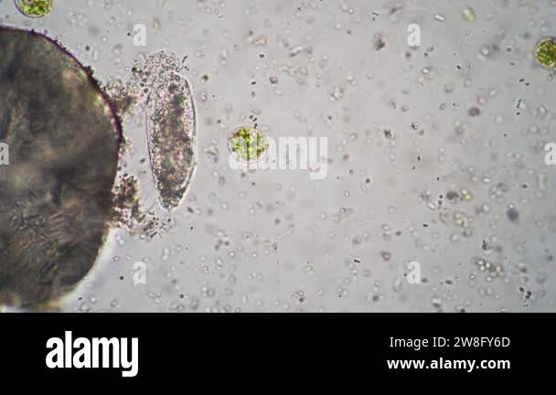 Infusoria is moving its legs and eating something filmed among bacillus ...