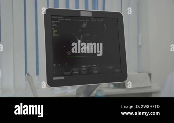 Woman doctor makes heart check of patient man using modern equipment in ...