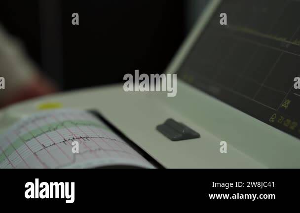 Electronic Cardiotocography Machine Monitoring Fetal Heart Contractions ...