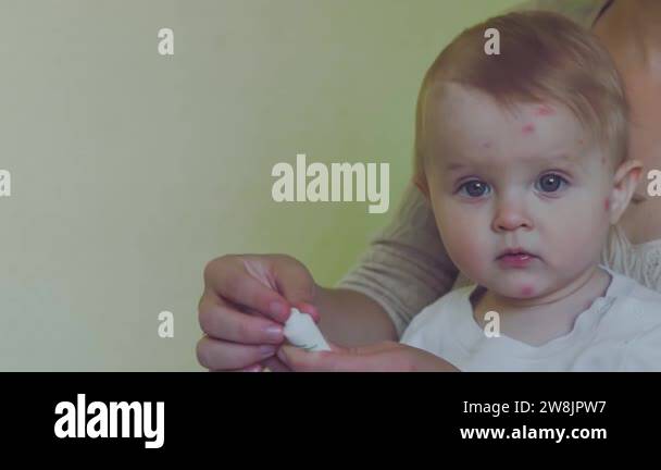 Skin rashes cream Stock Videos & Footage - HD and 4K Video Clips - Alamy