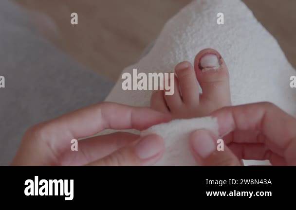Mother bandages her childs big toe. Close-up photo of kids foot with ...