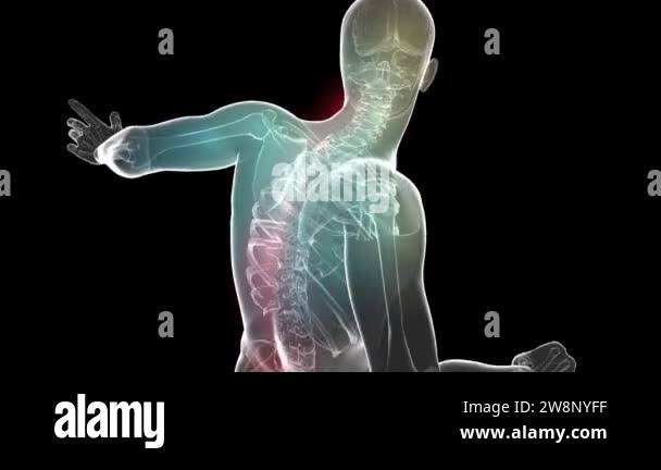 Anatomical 3d animation of the man figure graphically showing the pain ...