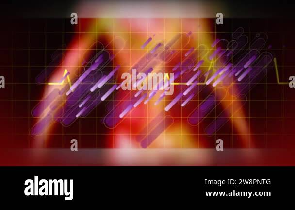 Animation of model of human body over lifeline on grid. global medicine ...