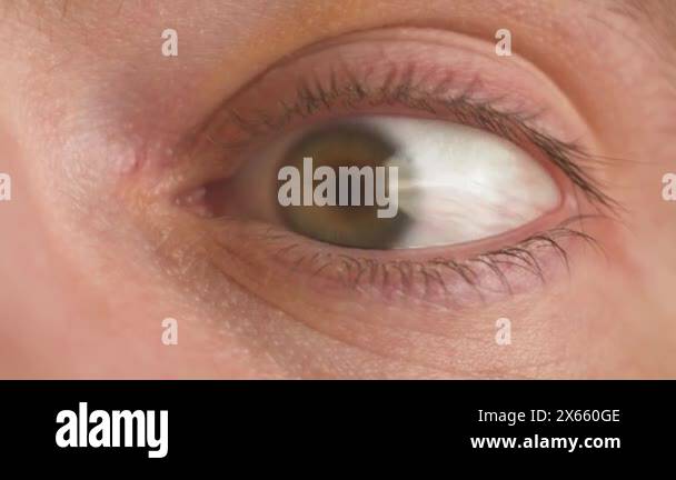 Man looks in different directions for external inspection of eye ...