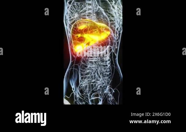 Ray liver Stock Videos & Footage - HD and 4K Video Clips - Alamy