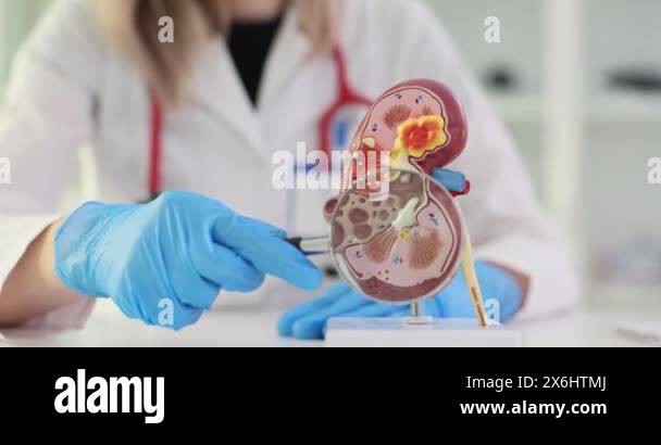 Doctor uses magnifying glass to explain kidney structure. Intricate ...
