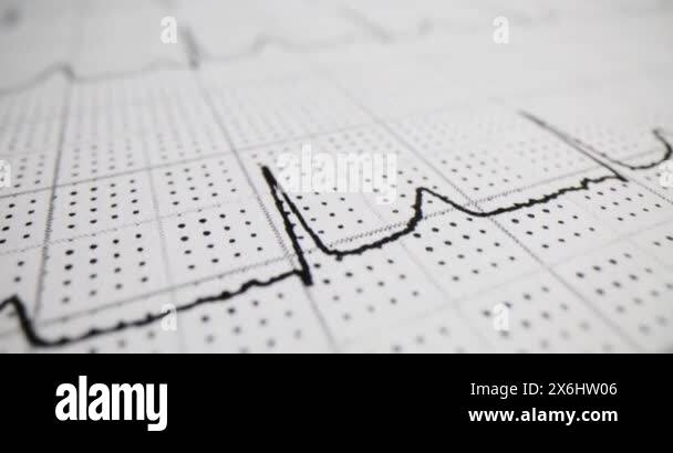 Methodology for recording and studying electrical fields generated ...