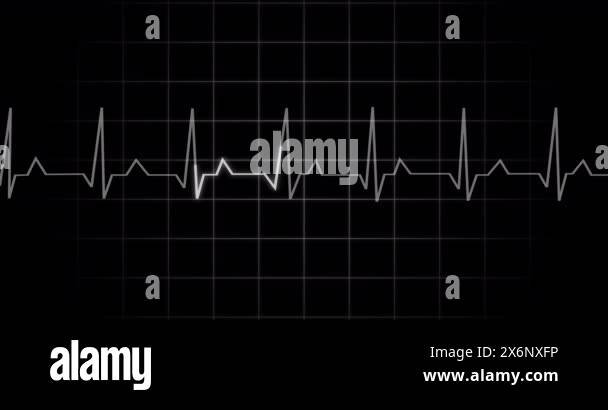 EKG Heartbeat reading animation on black background in 4K. Medical ...