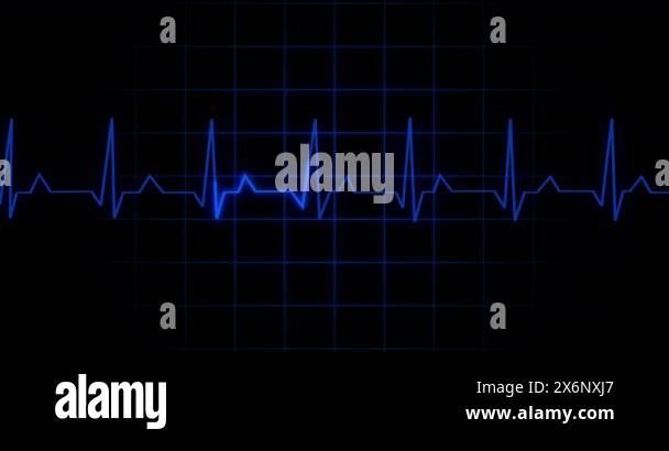 EKG Heartbeat reading animation on black background in 4K. Medical ...