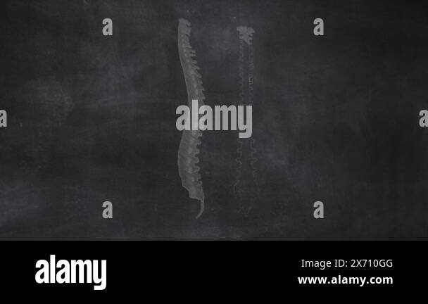 Human Spine Vertebral Column Anatomy Hand Drawn On Chalkboard Stock ...