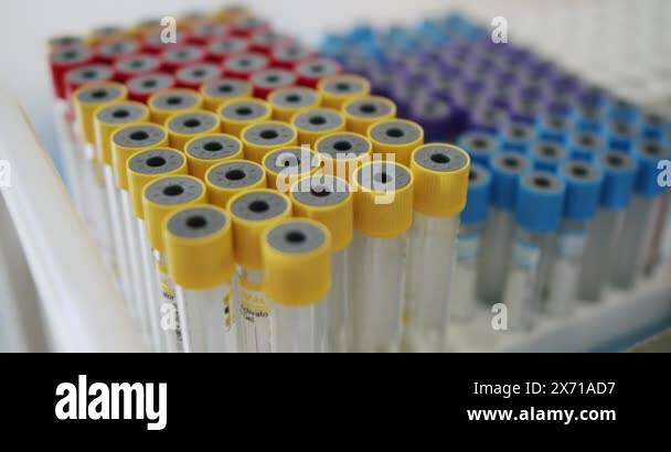 Gloved hand of a healthcare worker arranging labeled blood sample tubes ...