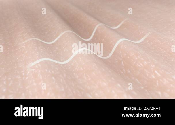 Skin wrinkle reduction. 3d rendering of human skin surface before and ...