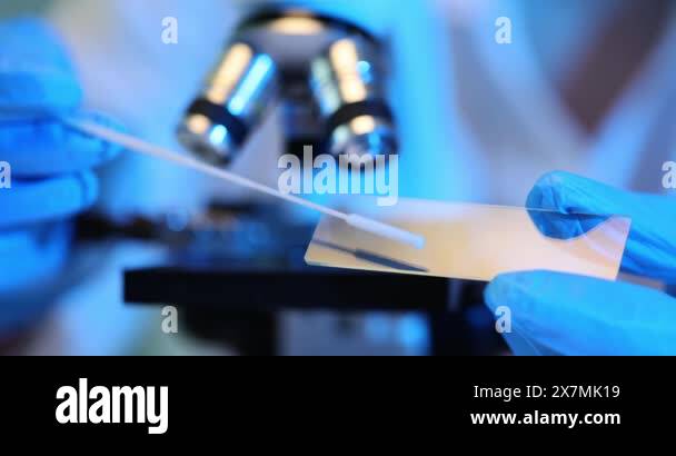 Microscope slide smear sample Stock Videos & Footage - HD and 4K Video ...