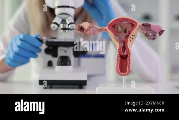 Microscopic analysis of female reproductive system. Diagnostic hysteroscopy of uterus Stock ...
