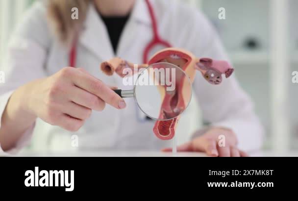 Gynecological model Stock Videos & Footage - HD and 4K Video Clips - Alamy
