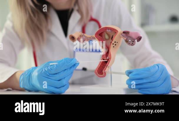 Model of human uterus and cervix taking analysis. Cytogram and ...