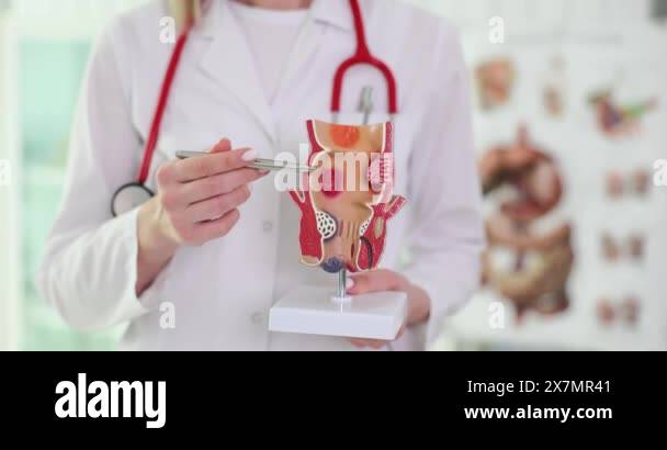 Rectal inflammation Stock Videos & Footage - HD and 4K Video Clips - Alamy